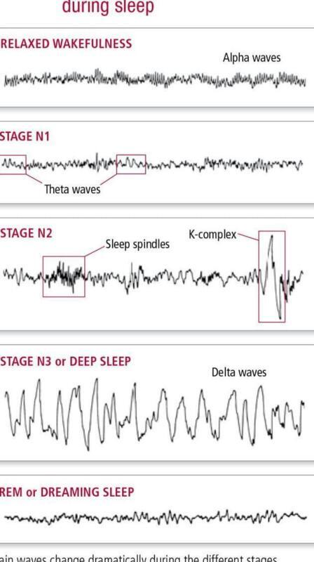 ENTENDIENDO las FASES del SUEÑO: ONDAS LENTAS y REM